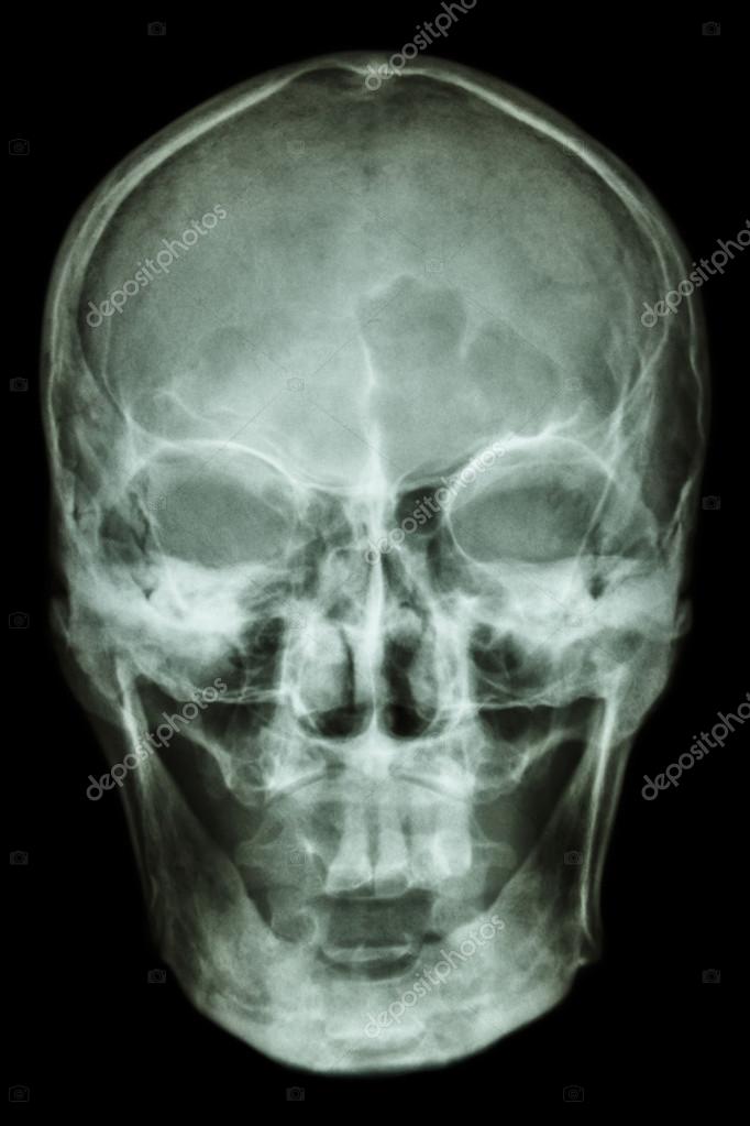 Normal human skull Stock Photo by ©stockdevil_666 61373033
