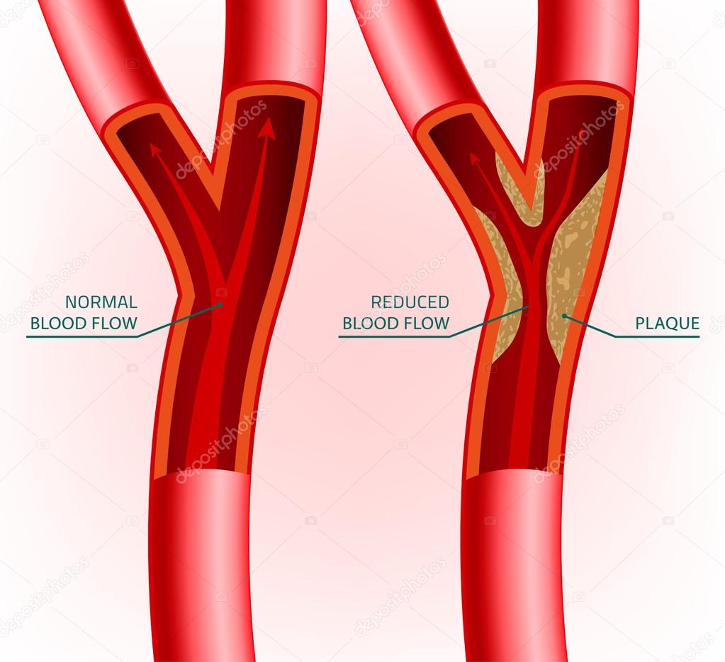 Blood Vein Image Stock Vector Image by ©annyart #104320466