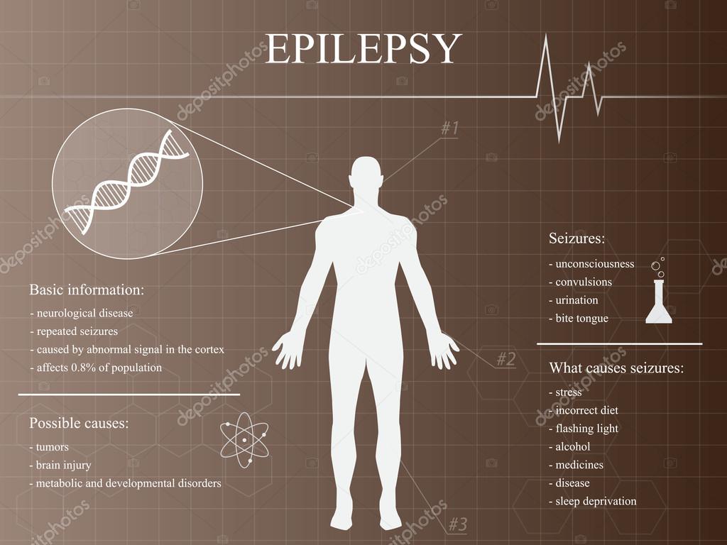 Epilepsy disease infographic with man silhouette Stock Vector Image by ...