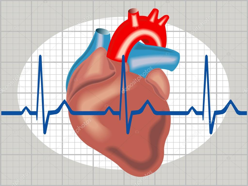 Cardiac Arrhythmia — Stock Vector © Rob3000 60338271