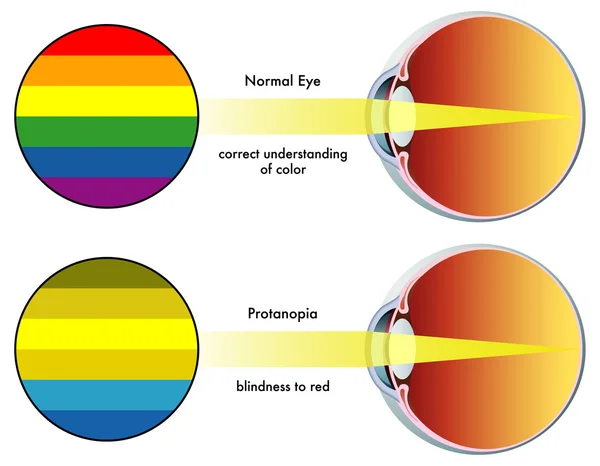 Tritanopia Stock Vector Image by ©rob3000 #60816663
