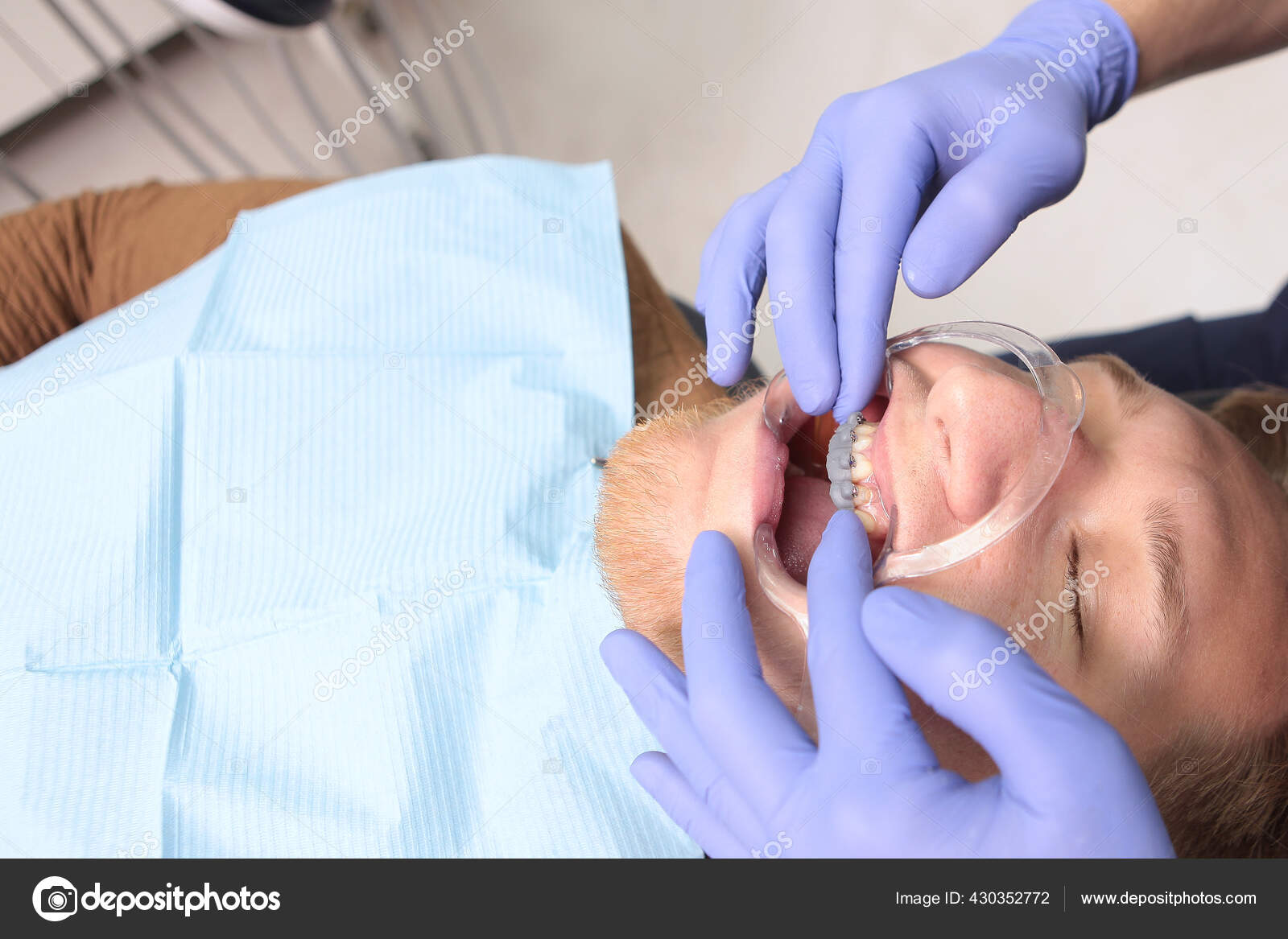 Anchors The Upper Row Of Teeth at Marsha Mitchell blog