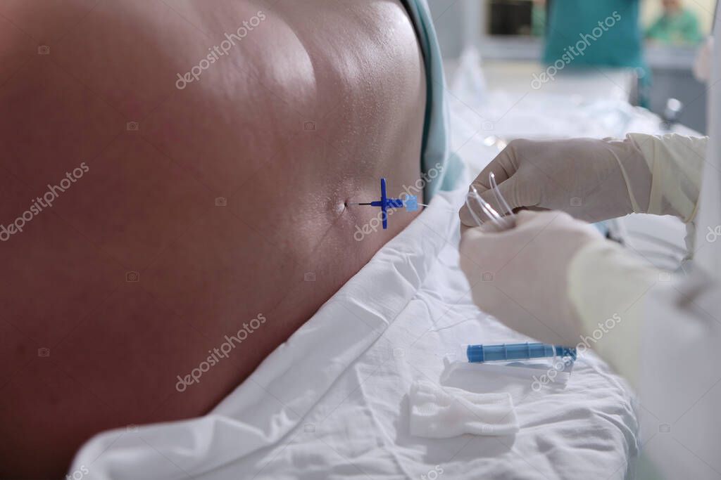 Inyecciones de raquianestesia Inyecciones de anestesia epidural en ...