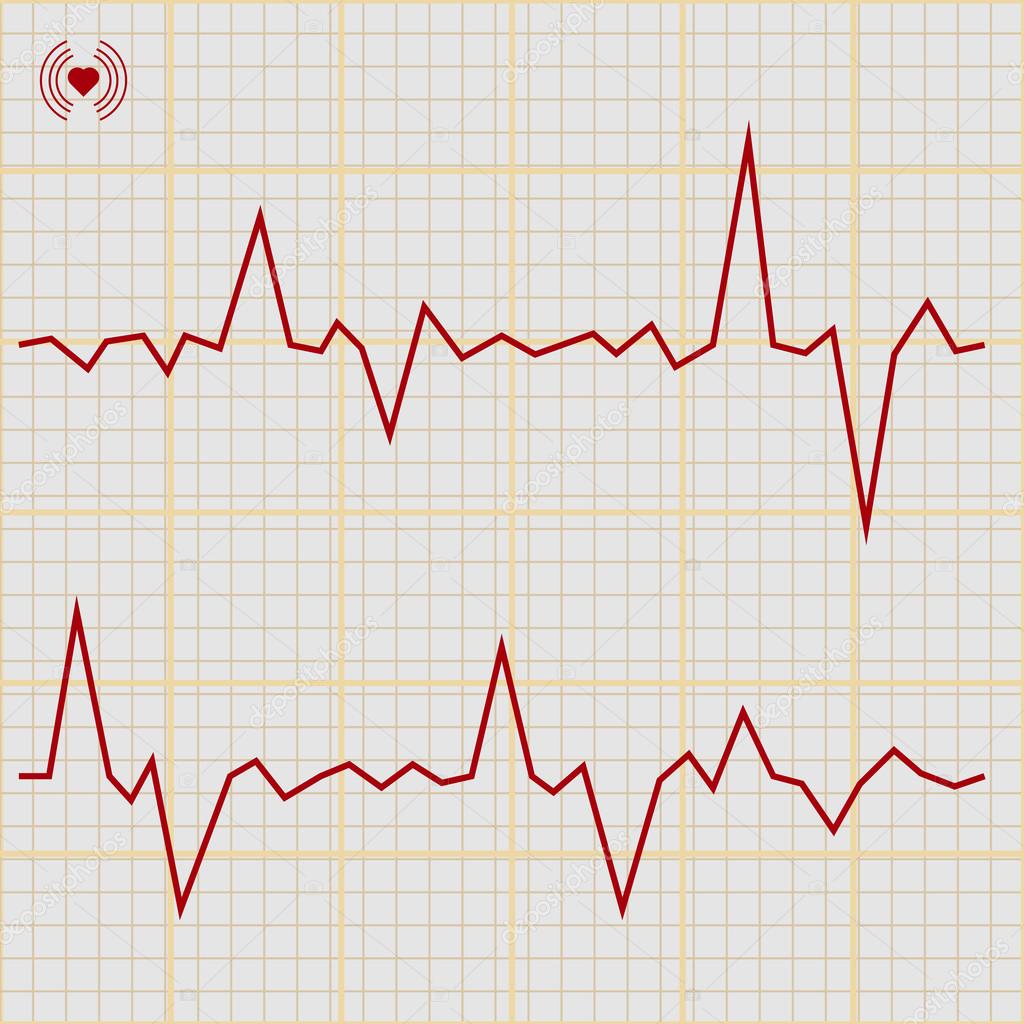 Vector Set of various cardiogram design elements. Stock Vector Image by ...