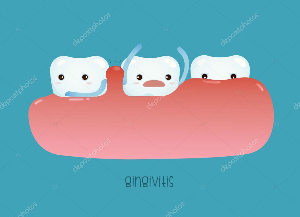 Gingivitis of dental vector Stock Vector Image by ©kninwong #68968993