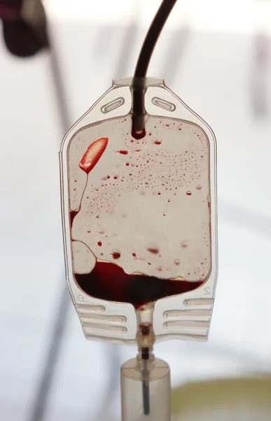 Empty blood bag Stock Photos, Royalty Free Empty blood bag Images ...