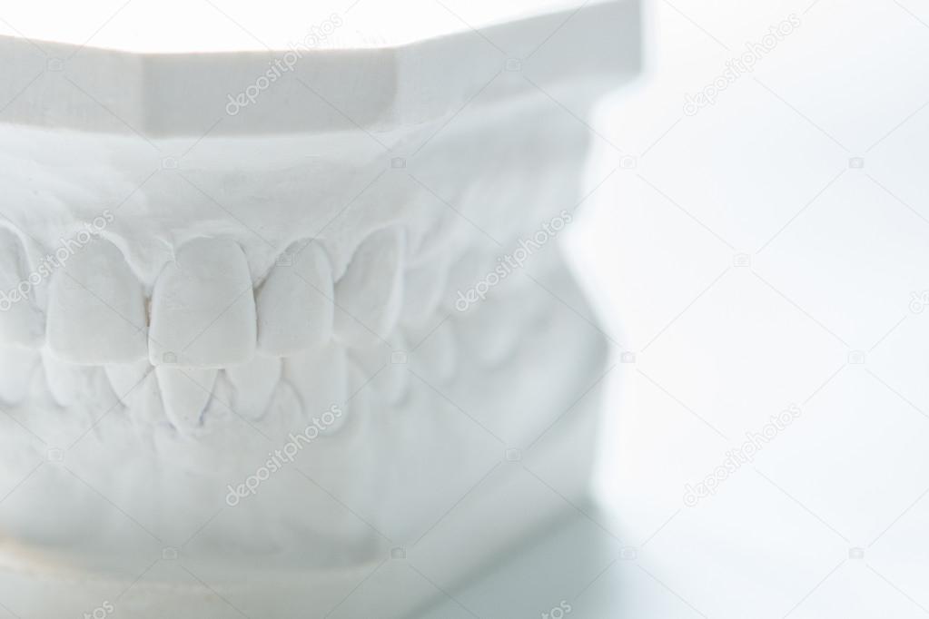 Gypsum model of human jaw on a white background. Stock Photo by ...