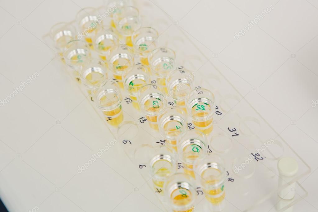 Lab tech loading samples into a chemistry analyzer — Stock Photo ...
