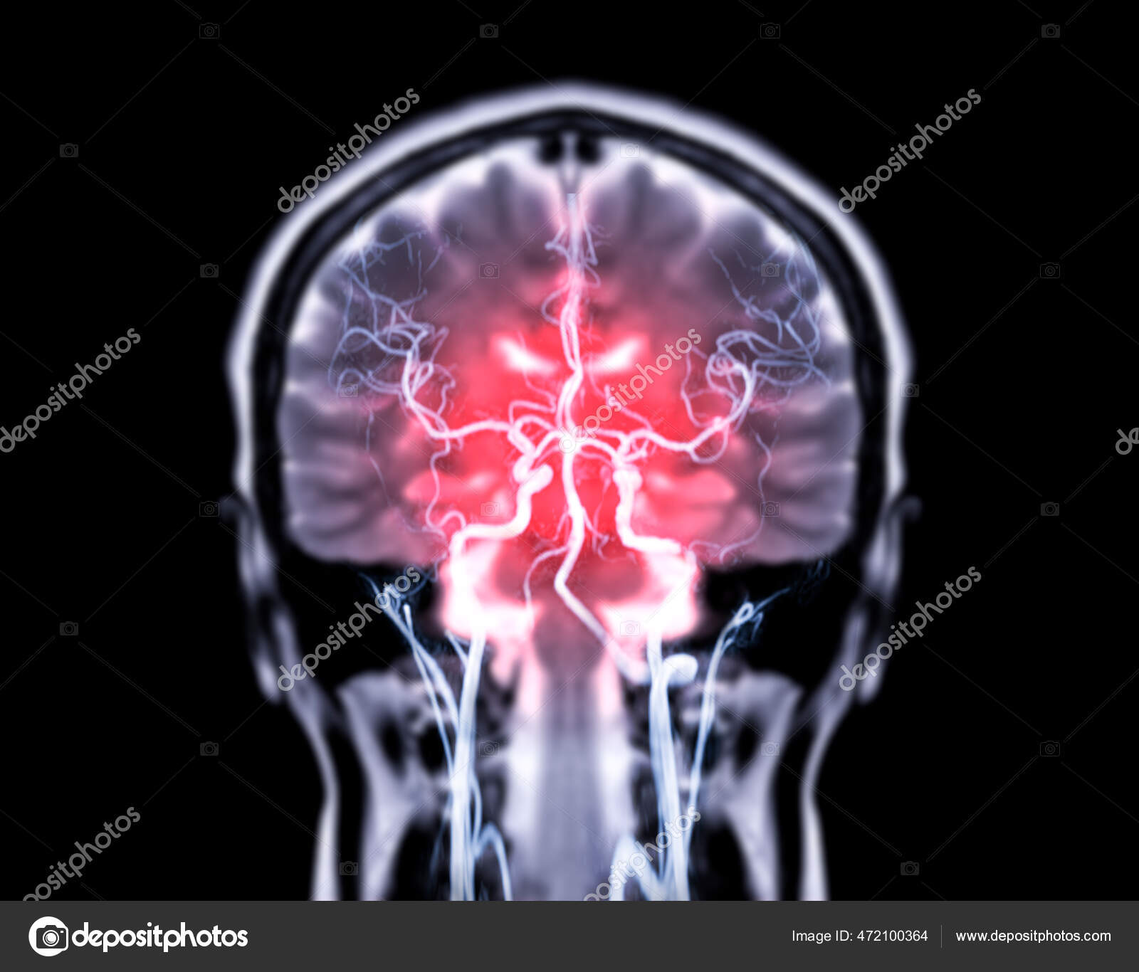 Brain Coronal View