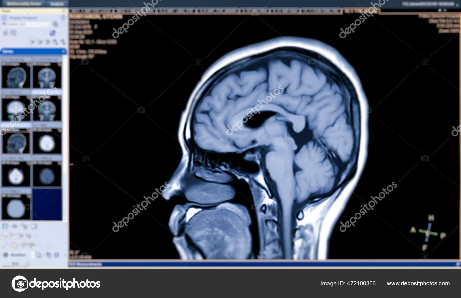 Irm Vue Sagittale Cerveau Pour Détecter Une Variété Conditions Cerveau — Photo de stock par ...