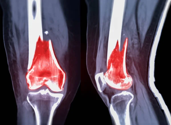 Knee joint ct Stock Photos, Royalty Free Knee joint ct Images ...