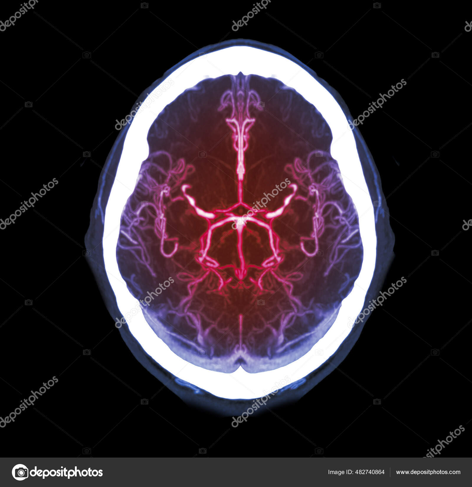 Axial View Of Brain