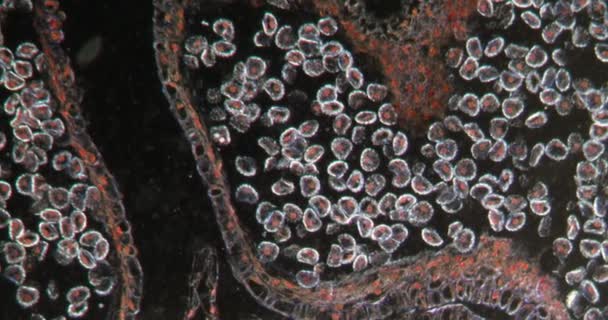 33 Lycopodium Videos, Royalty-free Stock Lycopodium Footage | Depositphotos