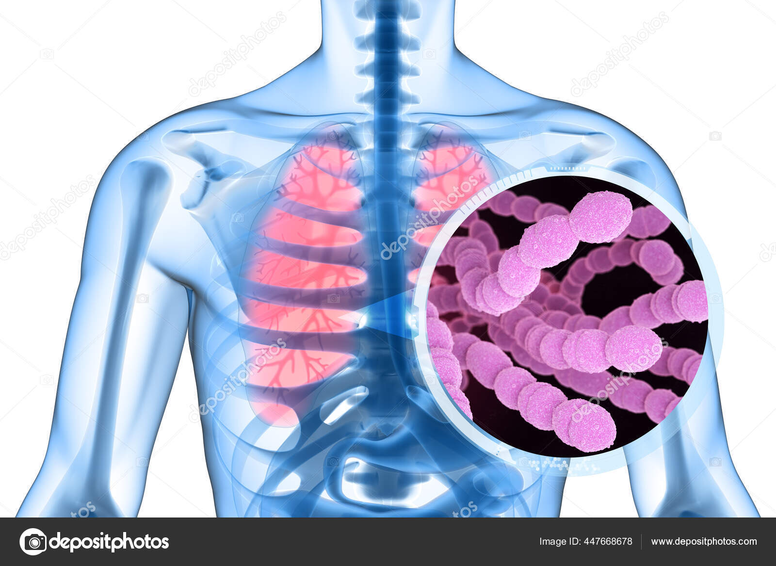 Streptococcus Pneumoniae Neumococo Una Bacteria Patógena Forma Coco ...