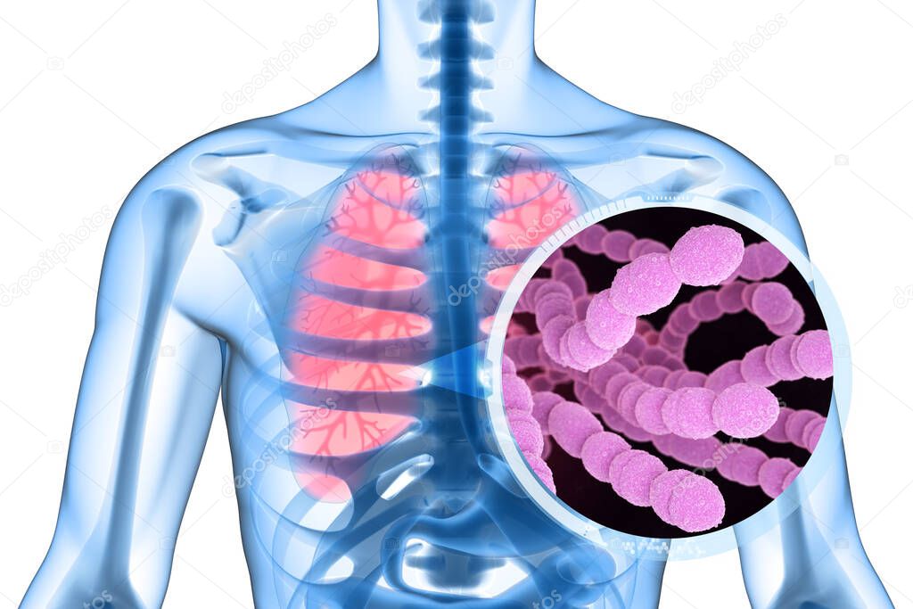 Streptococcus pneumoniae, o neumococo, es una bacteria patógena en forma de coco grampositivo ...