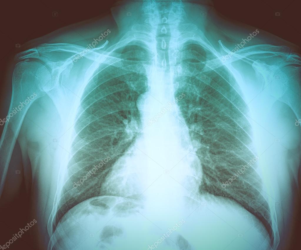 Retro look Rayons X médicaux image libre de droit par teresinagoia ...