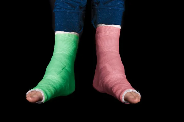 Pictures: black and white leg cast | White leg cast — Stock Photo ...