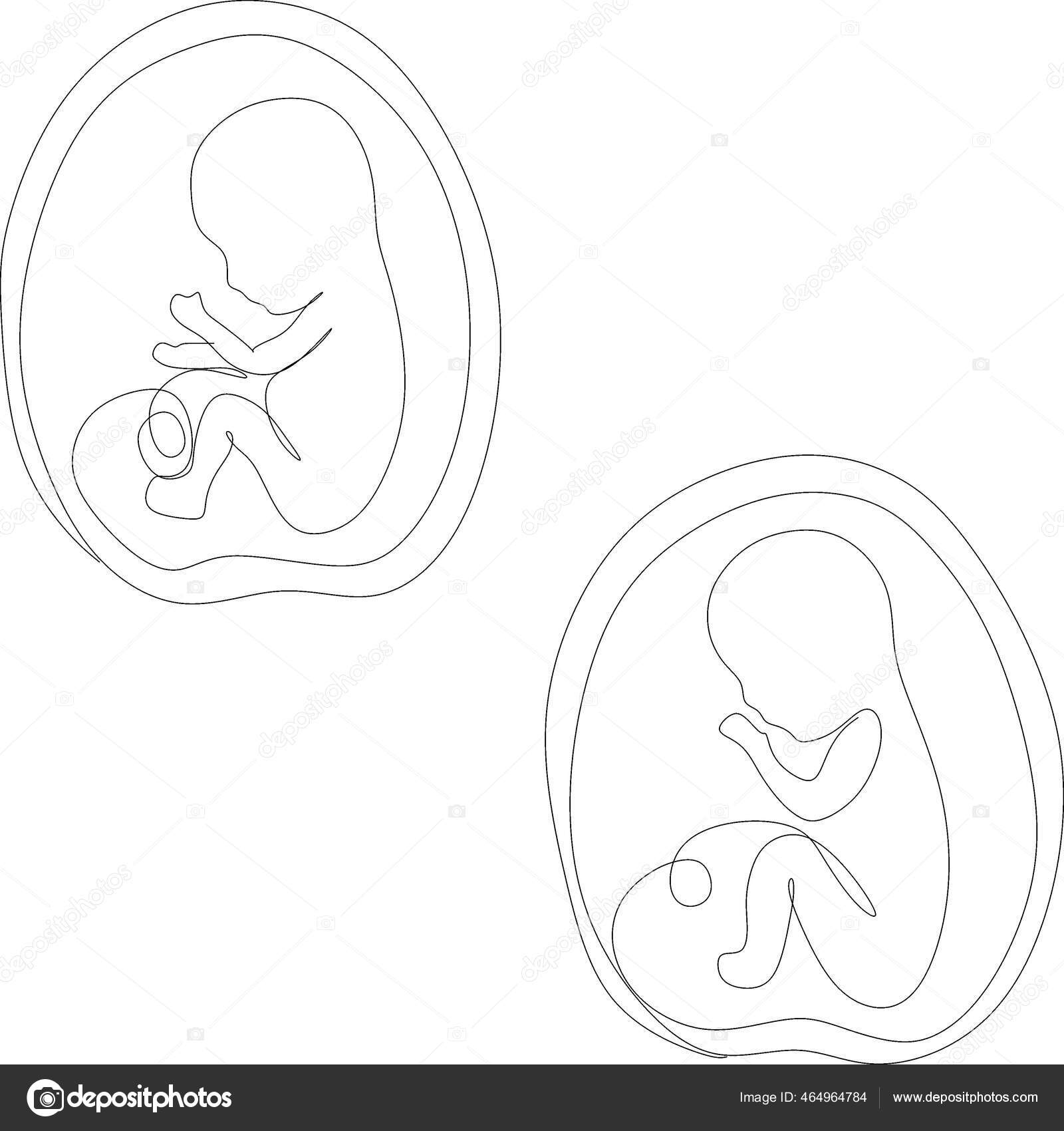 Baby Womb One Single Line Drawing Cute Unborn Fetus Baby Stock Vector ...