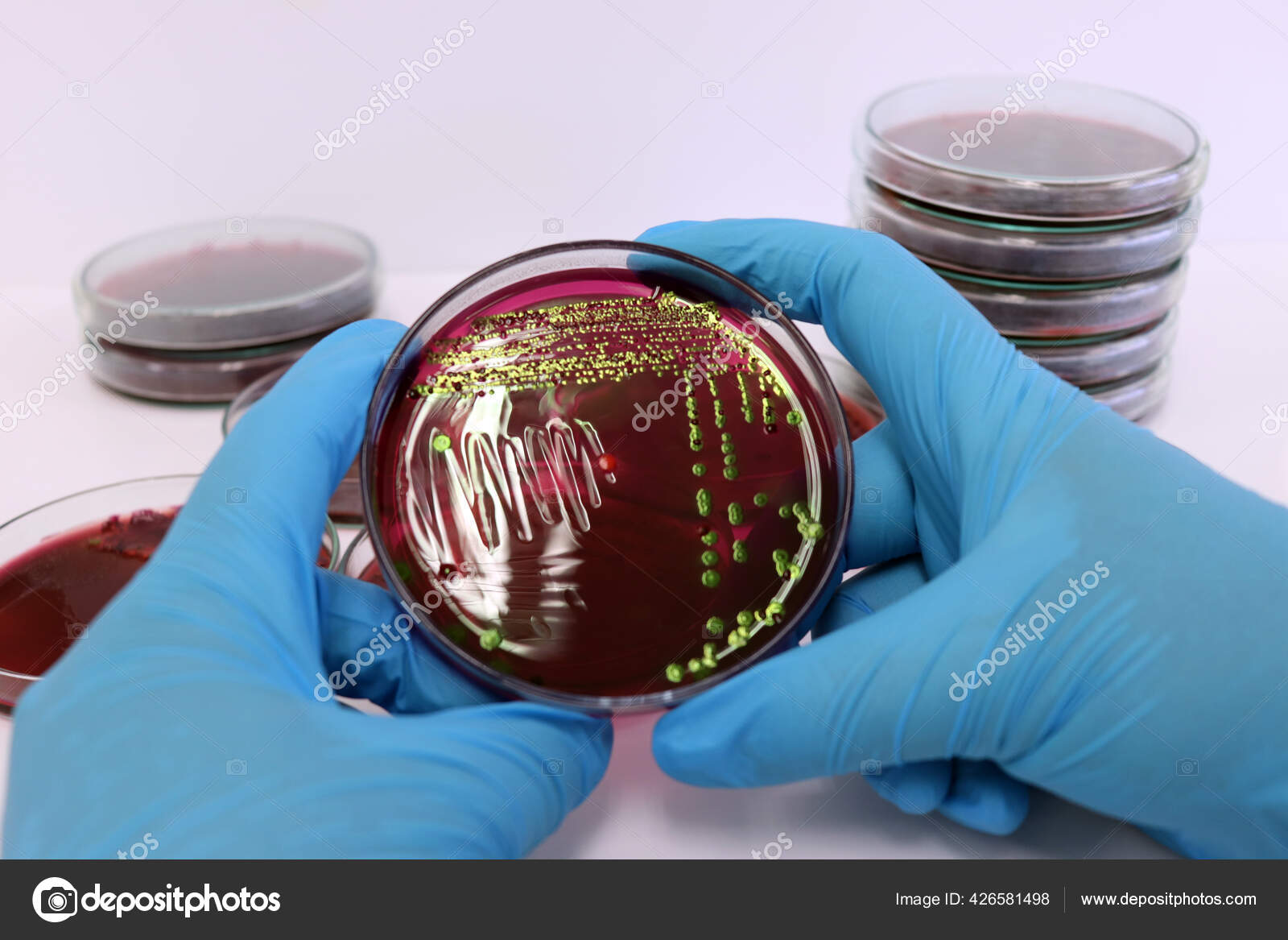 Eosin Methylene Blue Agar