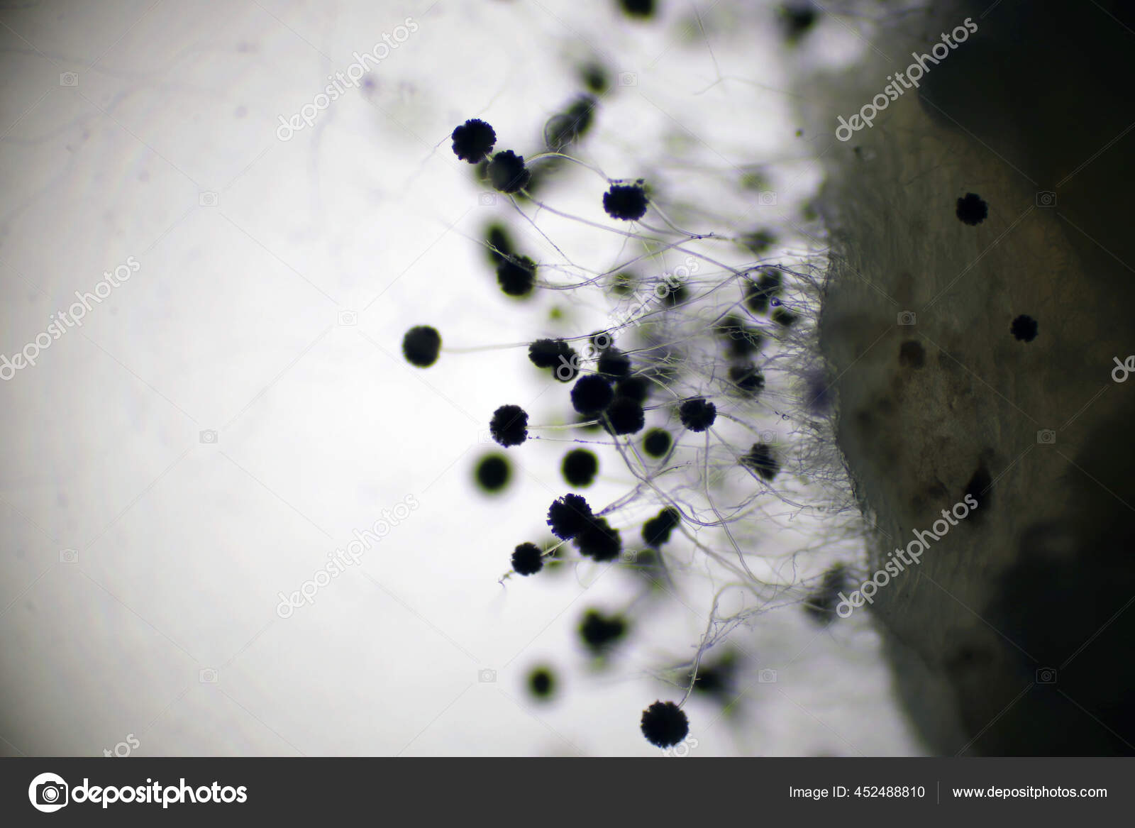 Vista Del Microscopio Esporas Hongos Negros Moldes Levaduras Con Lentes ...