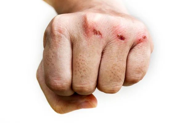 Wound care doctor Stock Photos, Royalty Free Wound care doctor Images ...