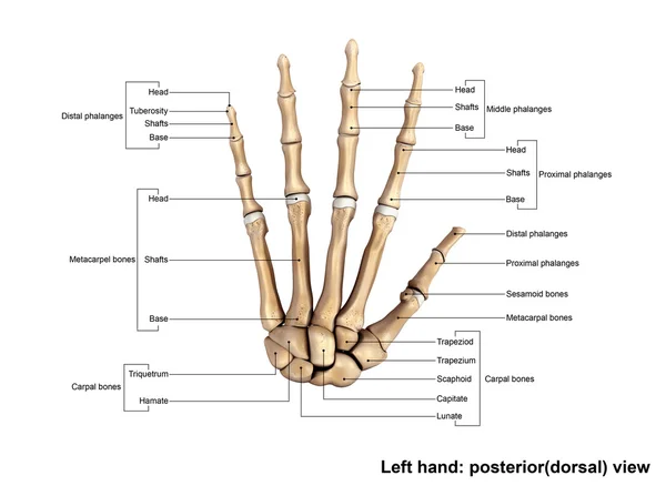 hallux valgus - pathogenic mechanism, lateral deviation of the first ...