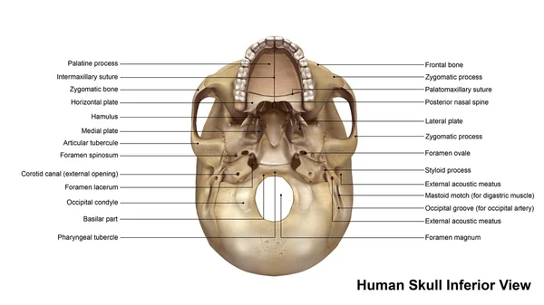 Inferior View Of Skull Mandible Removed