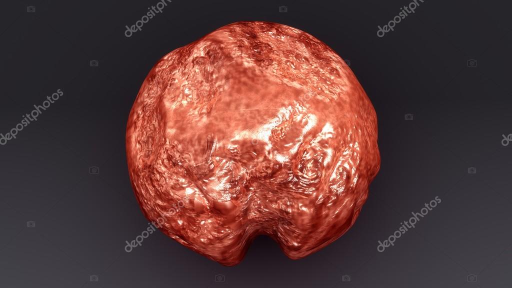 Human Granuloma inflammation Stock Photo by ©sciencepics 123334748