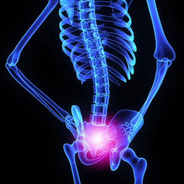 Hip joint — Stock Photo © sciencepics #73312021