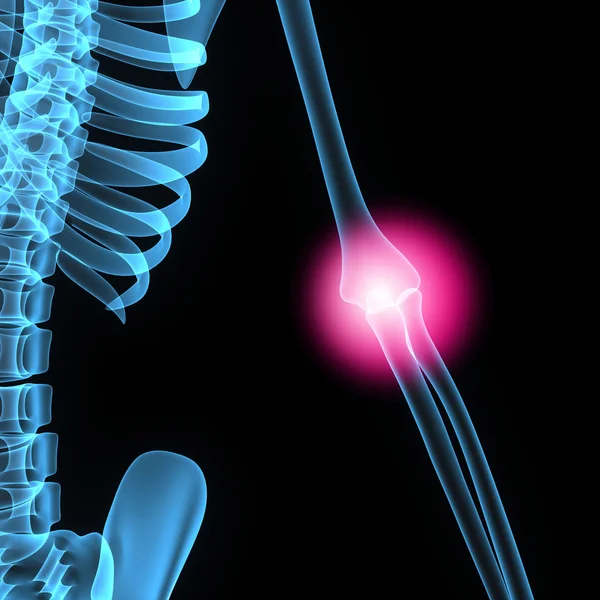 Human joints icon Stock Photos, Royalty Free Human joints icon Images ...