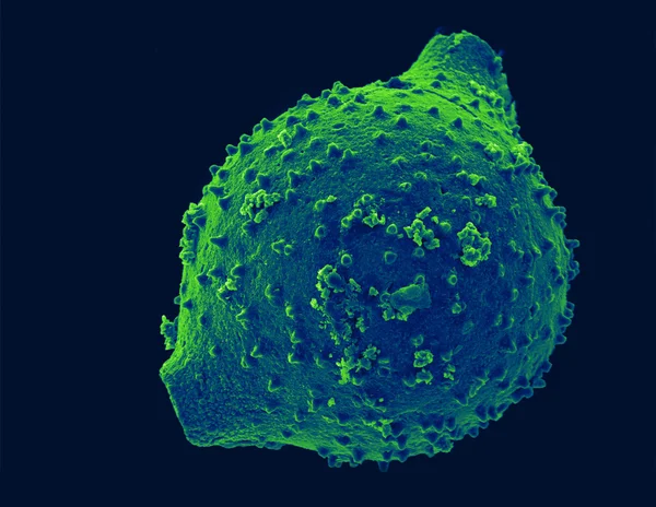 Foraminifera Stock Photos, Royalty Free Foraminifera Images ...