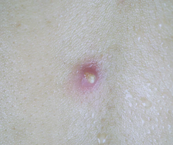 Scalp scab Stock Photos, Royalty Free Scalp scab Images | Depositphotos