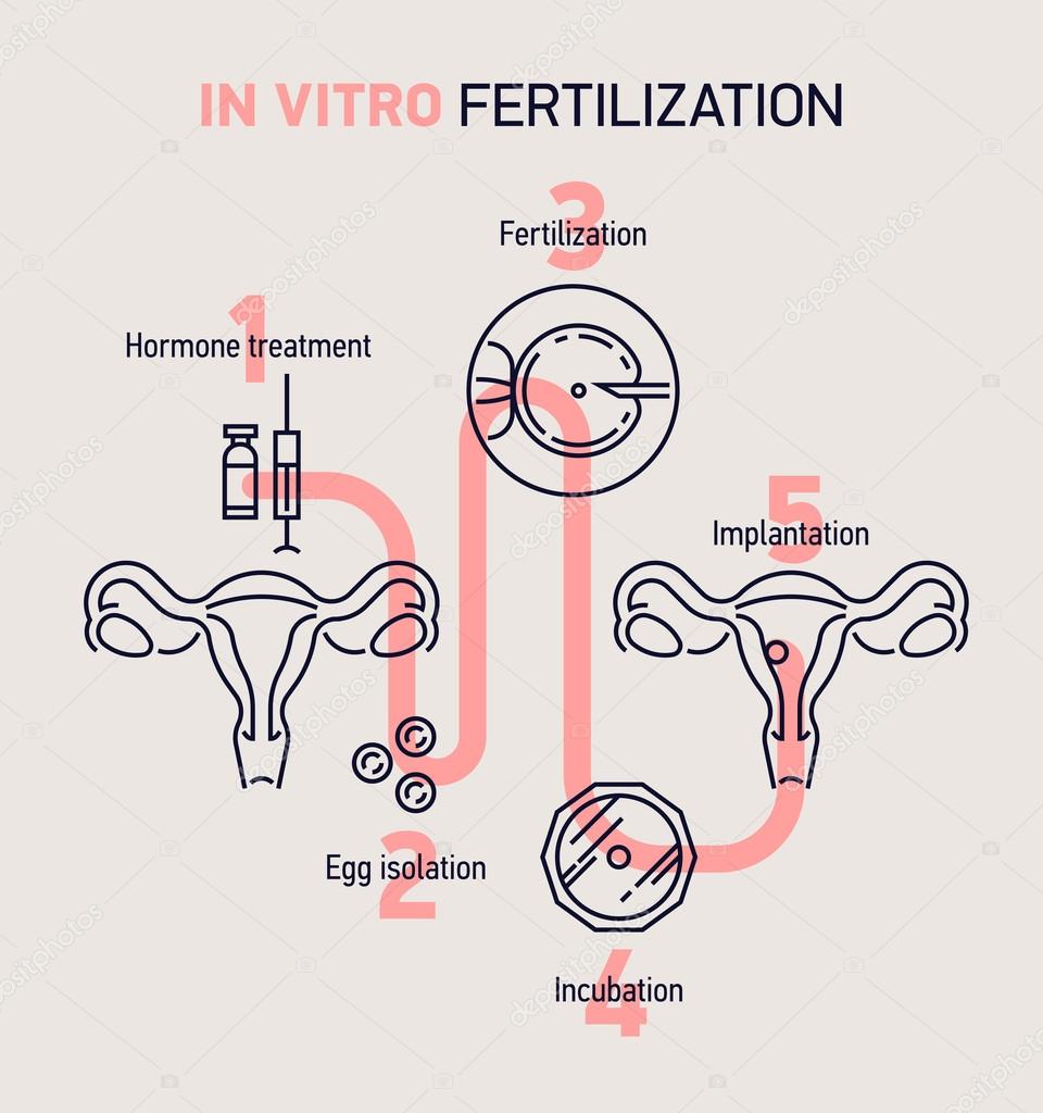 Female Infertility Treatment Stages — Stock Vector © Masha Tace 102839514