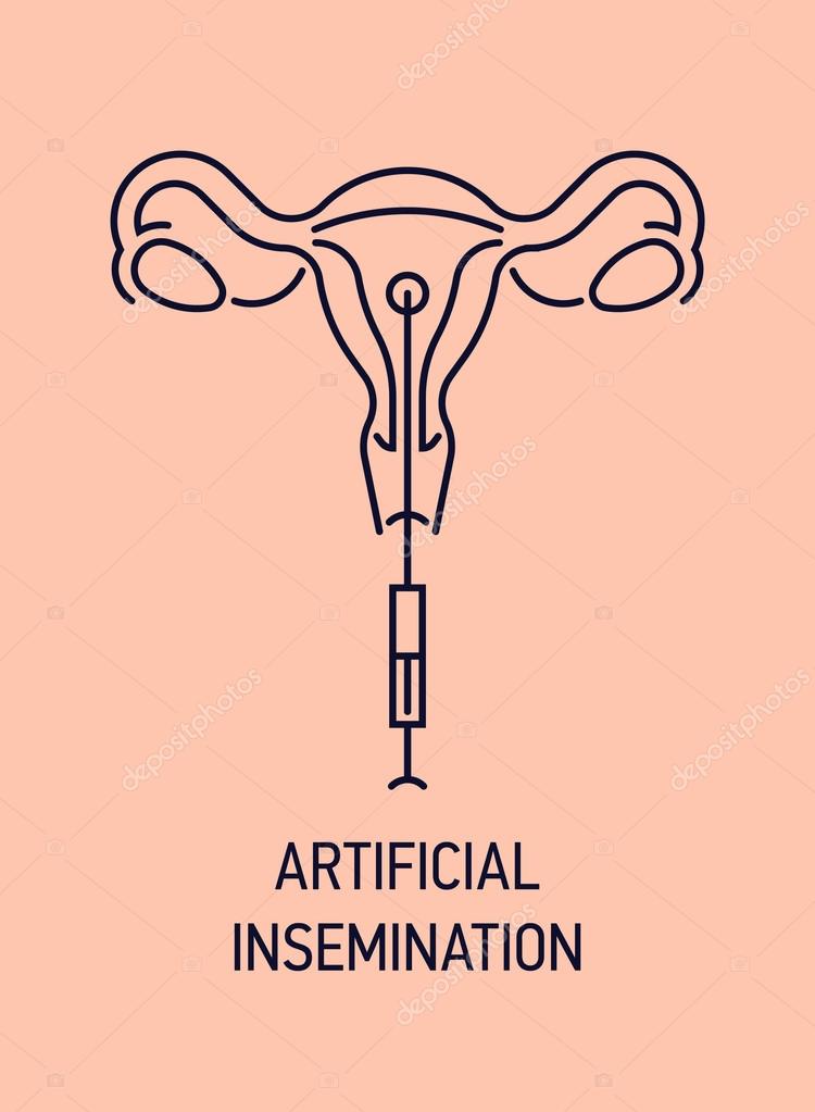 Diagrama de inseminación artificial Vector de stock #102843146 de ...