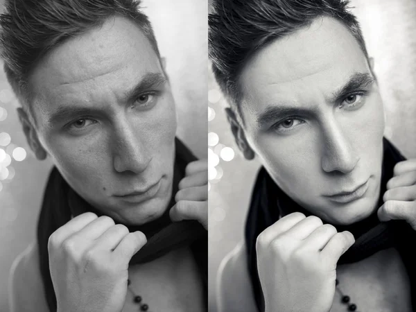 Botox before after Stock Photos, Royalty Free Botox before after Images ...