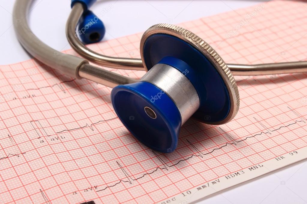 Stethoscope with electrocardiogram graph report Stock Photo by ...