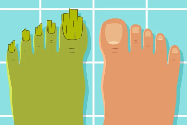 61 Big toes Vector Images, Big toes Illustrations | Depositphotos