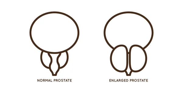 Cartoon enlarged prostate, Royalty-free Cartoon enlarged prostate ...