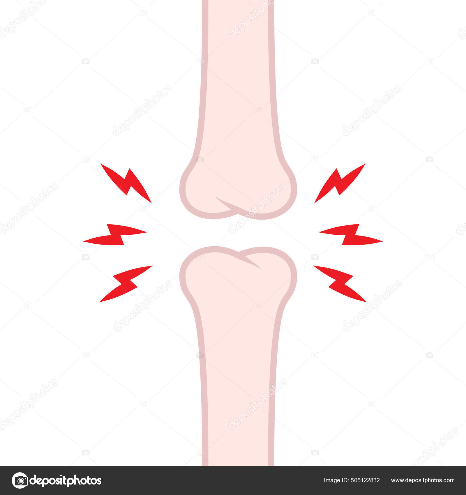 Knee Bone Problems Bone Cartoon Vector Stock Vector by ©jumpingxiii ...