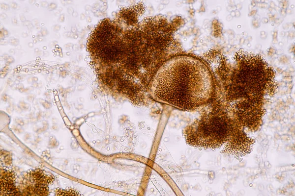 Aspergillus Conidia 100x