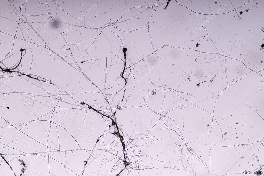 Características de Rhizopus es un género de hongos saprofitos comunes ...