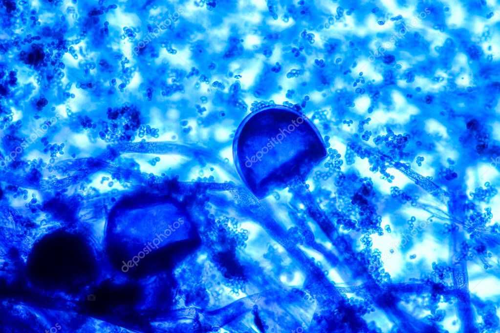 Características de Rhizopus es un género de hongos saprofitos comunes ...