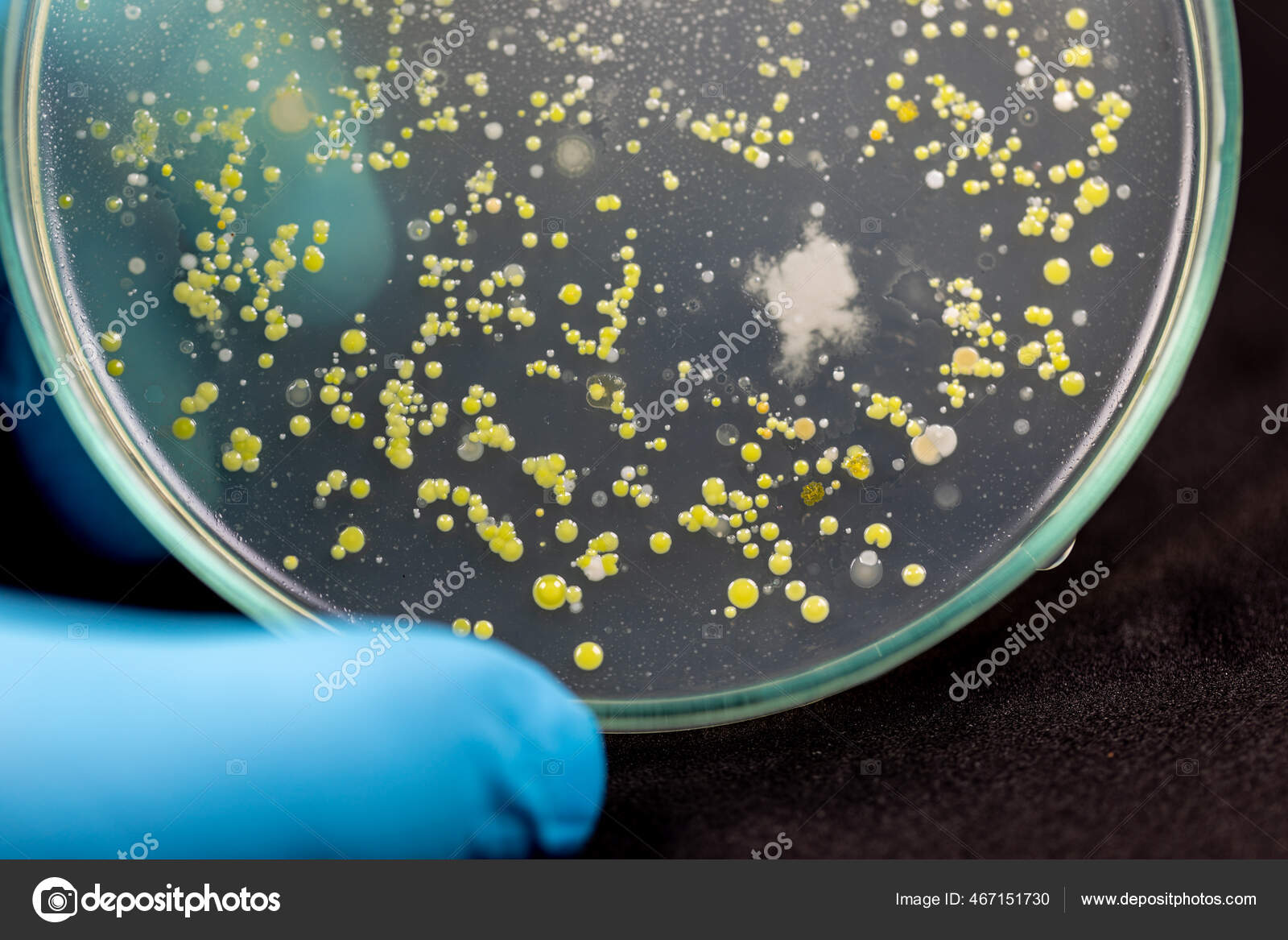 Actinomyces Colony Morphology