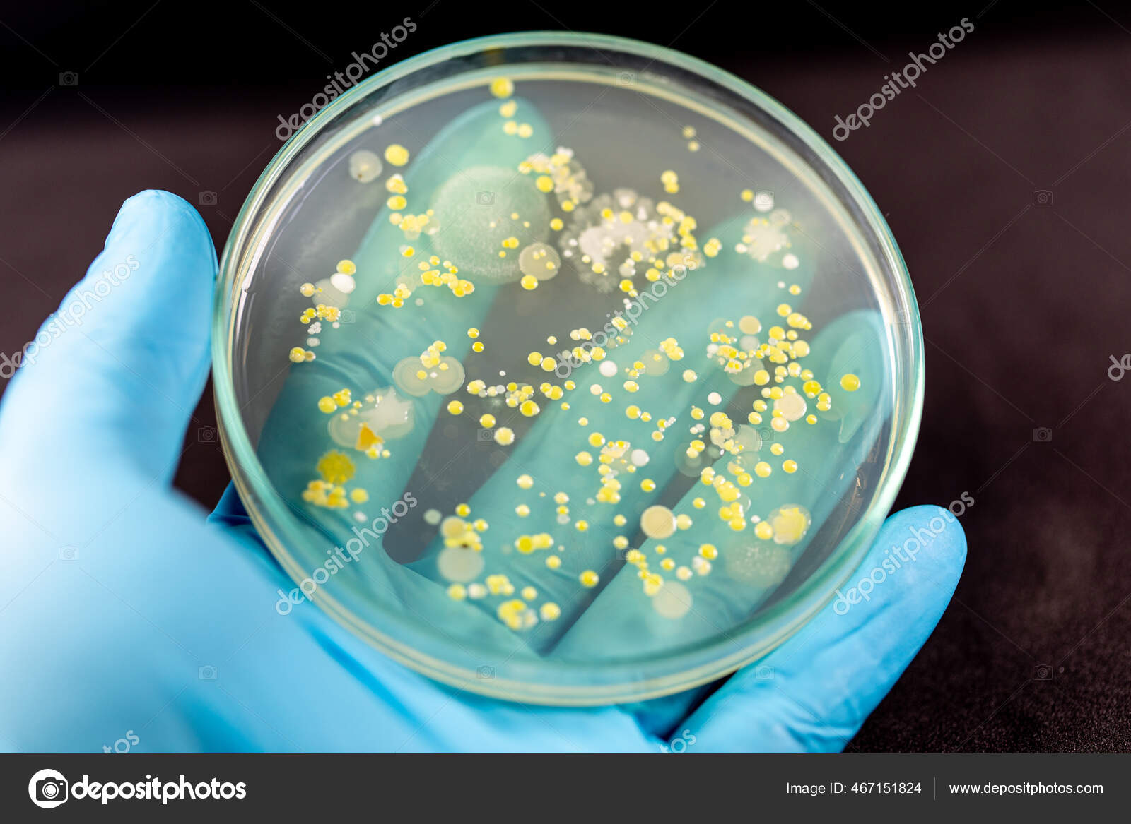 Soil Bacteria On Agar Plate