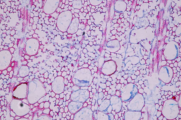 Palisade tissue Stock Photos, Royalty Free Palisade tissue Images ...