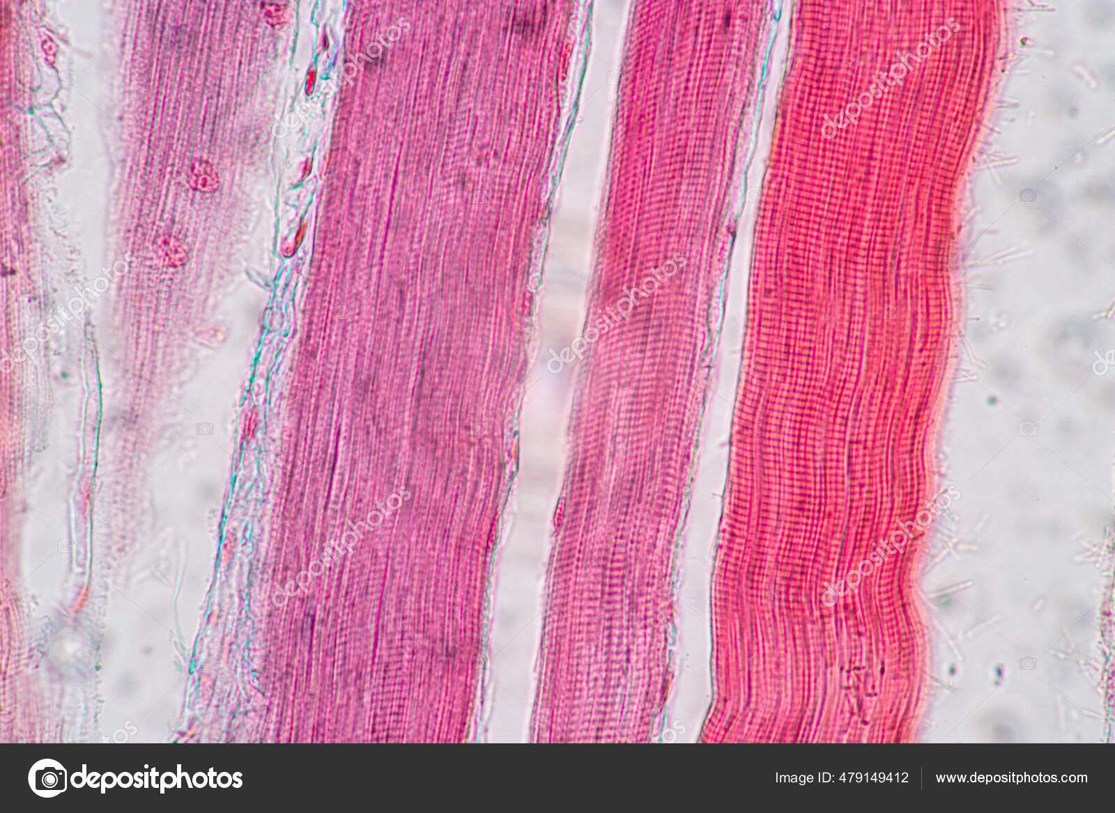 Características Anatomía Muestra Histológica Músculo Estriado ...