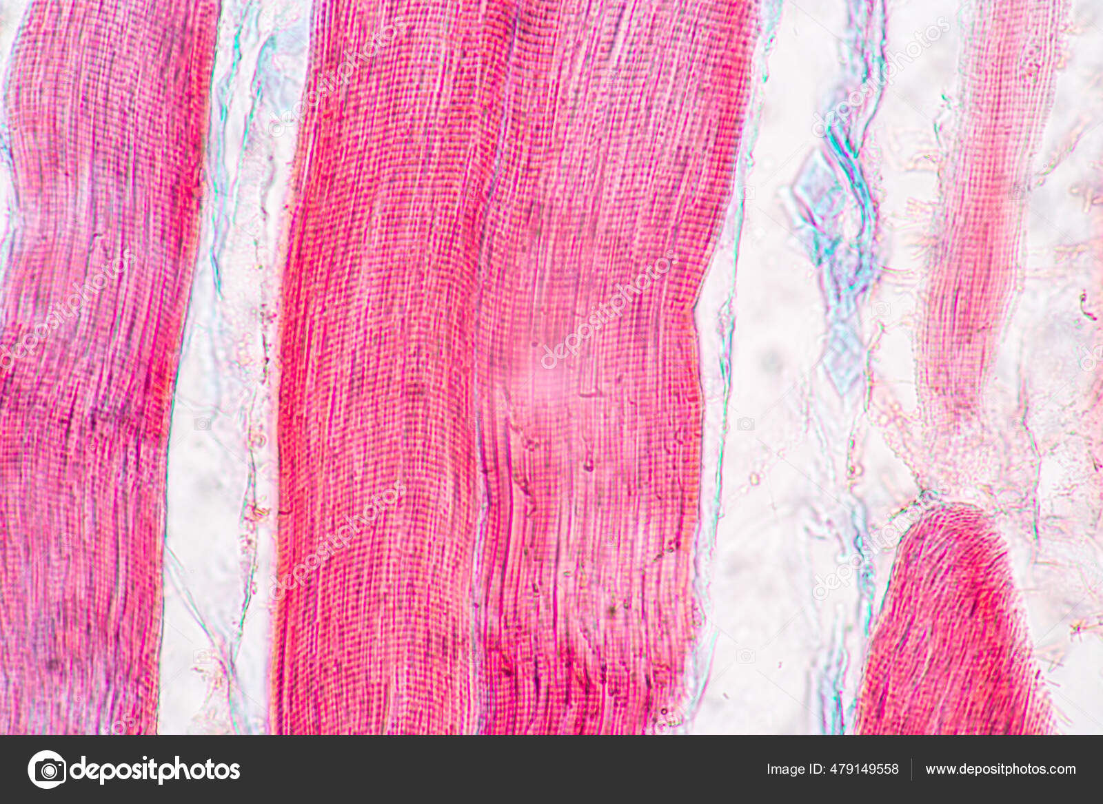 Characteristics Anatomy Histological Sample Striated Skeletal Muscle ...