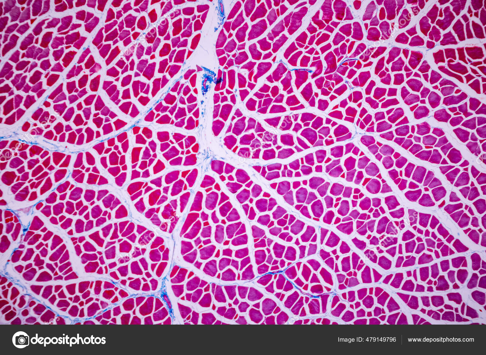 Características Anatomía Muestra Histológica Músculo Estriado ...