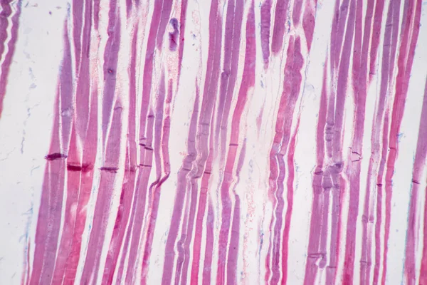 Characteristics Anatomy Histological Sample Striated Skeletal Muscle ...