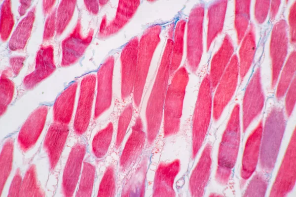 Characteristics Anatomy Histological Sample Striated Skeletal Muscle ...